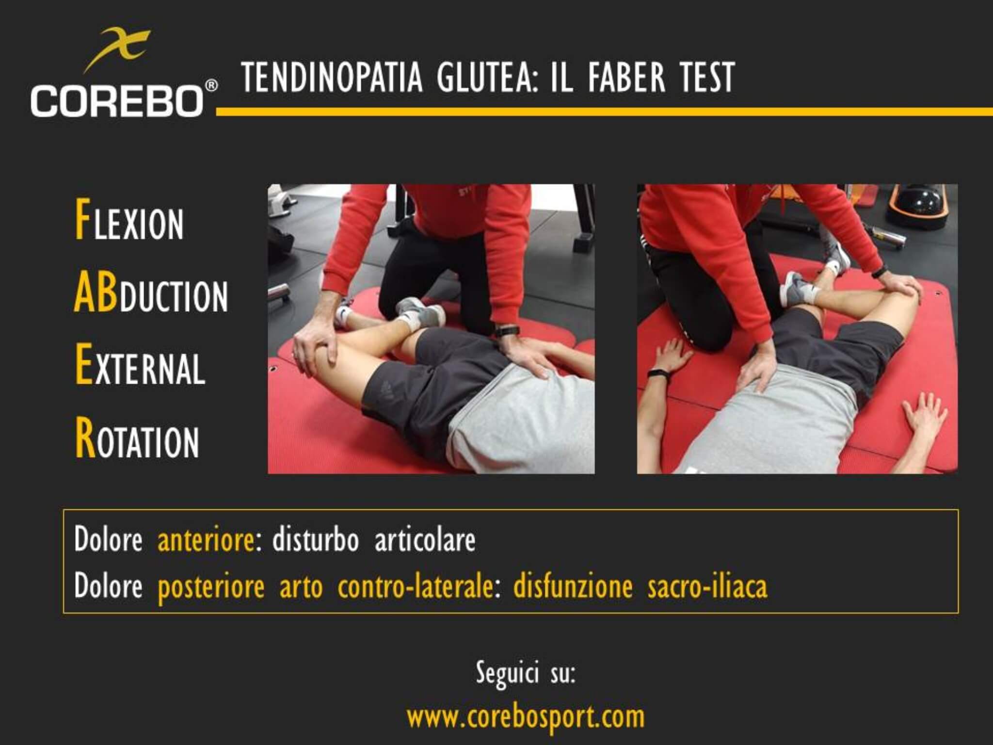 La tendinopatia glutea e sport: cosa sapere - COREBO