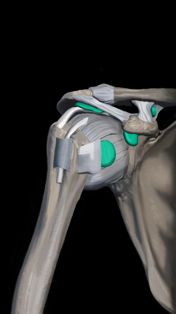Anatomia della spalla: articolazione ed aspetti muscolari - COREBO